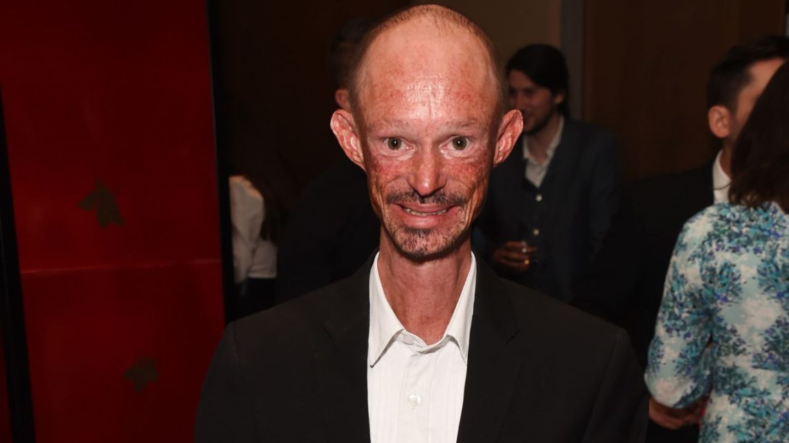 'Game of Thrones' Star Darren Kent Looked Happier Than Ever in Viral ...